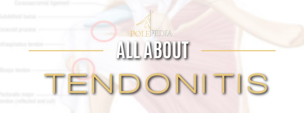 All About Tendonitis - Pole Dance Injuries | PolePedia